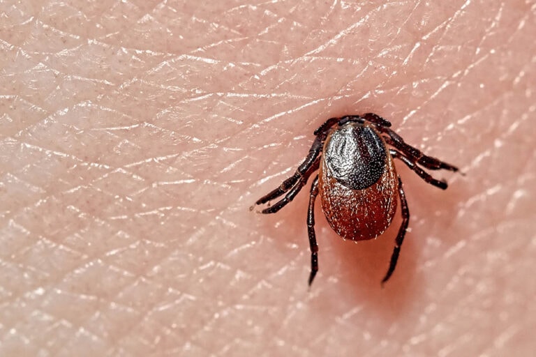 3 Types of Ticks in Wisconsin (with Pictures) | Home Grail