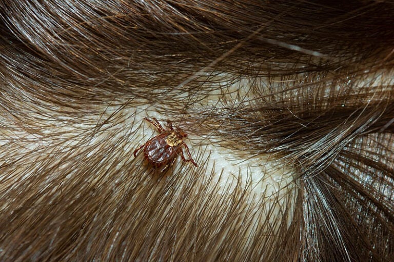 7 Types of Ticks in Oregon (With Pictures) | Home Grail